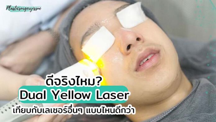 Dual Yellow Laser ดีจริงไหม? เทียบกับเลเซอร์อื่นๆ แบบไหนเห็นผลกว่ากัน ...